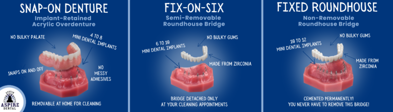 Full Dentures in Austin, TX | Mini Implant Denture Options | Dr. Hall